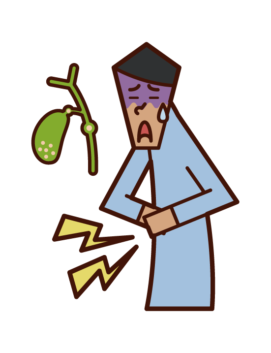 Illustration of cholelithiosis and cholecystitis (man) – KuKuKeKe